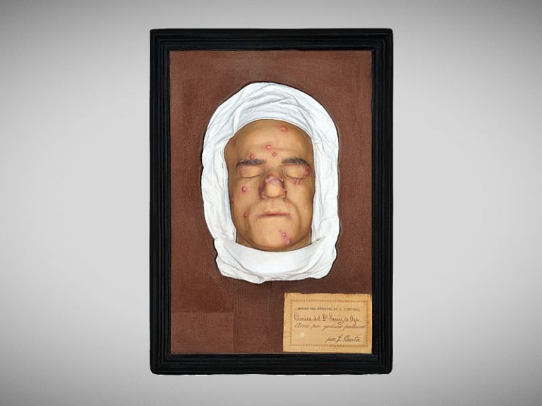 Trastornos acneiformes archivos - Museo Olavide